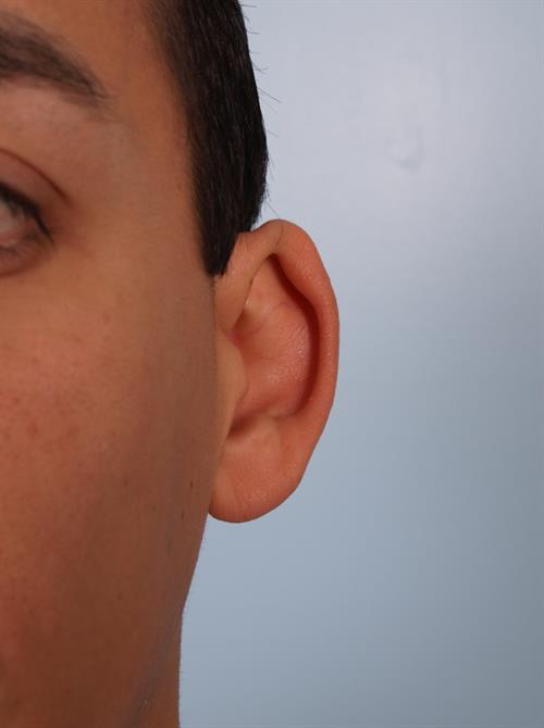 Ear Front View